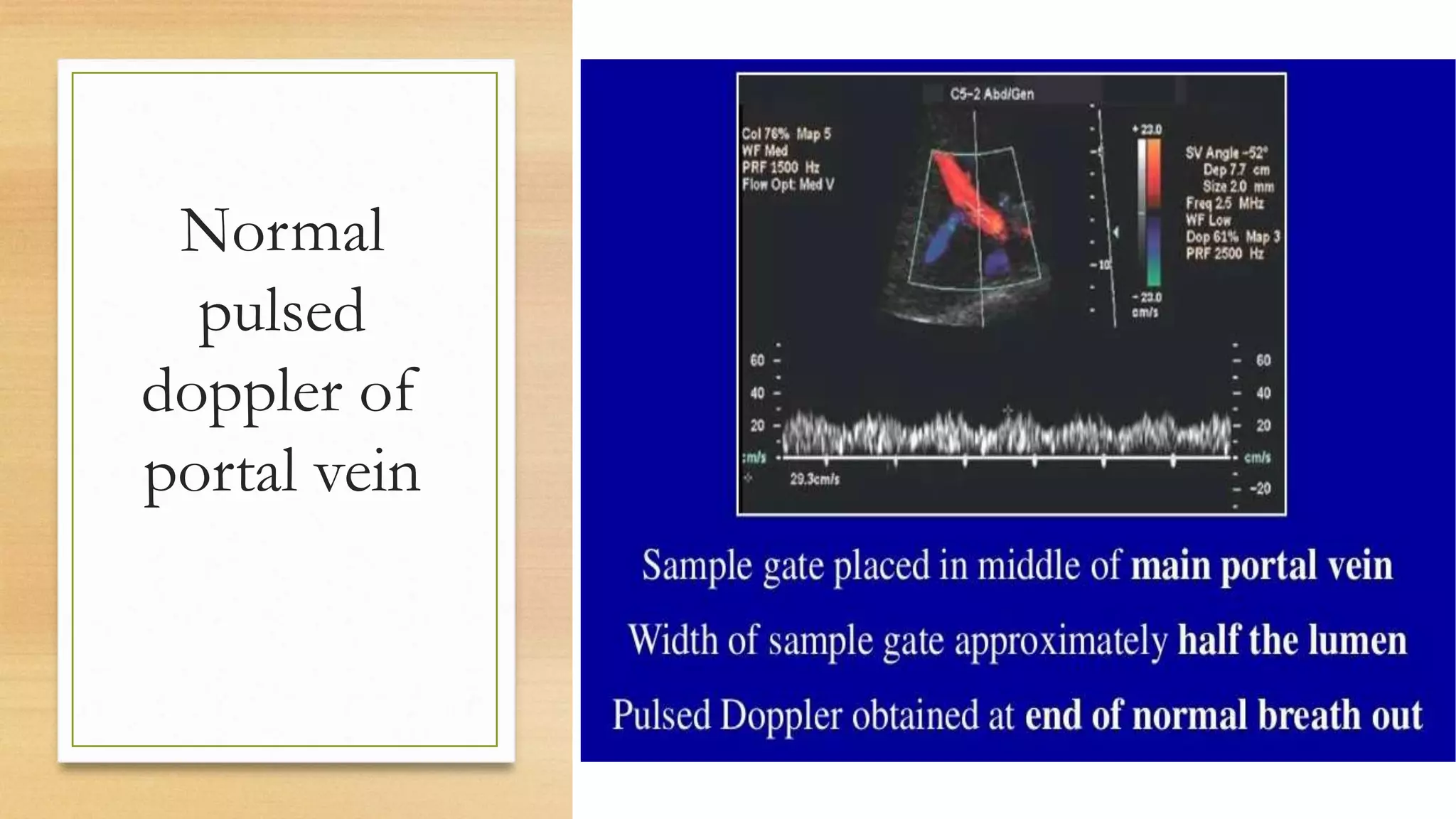 portal doppler ppt .pptx