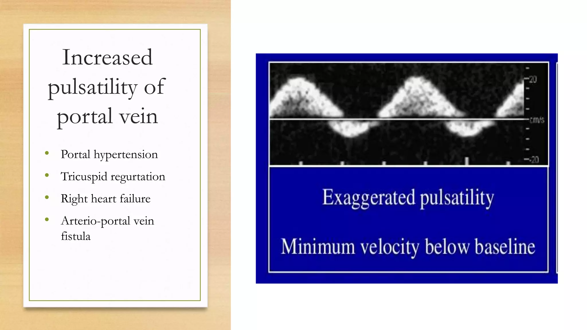 portal doppler ppt .pptx