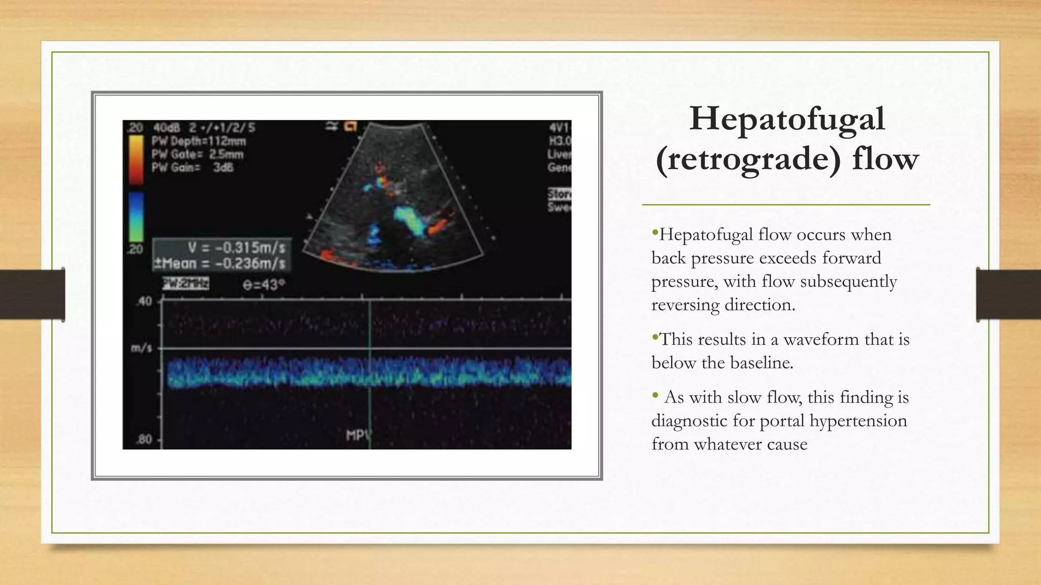 portal doppler ppt .pptx