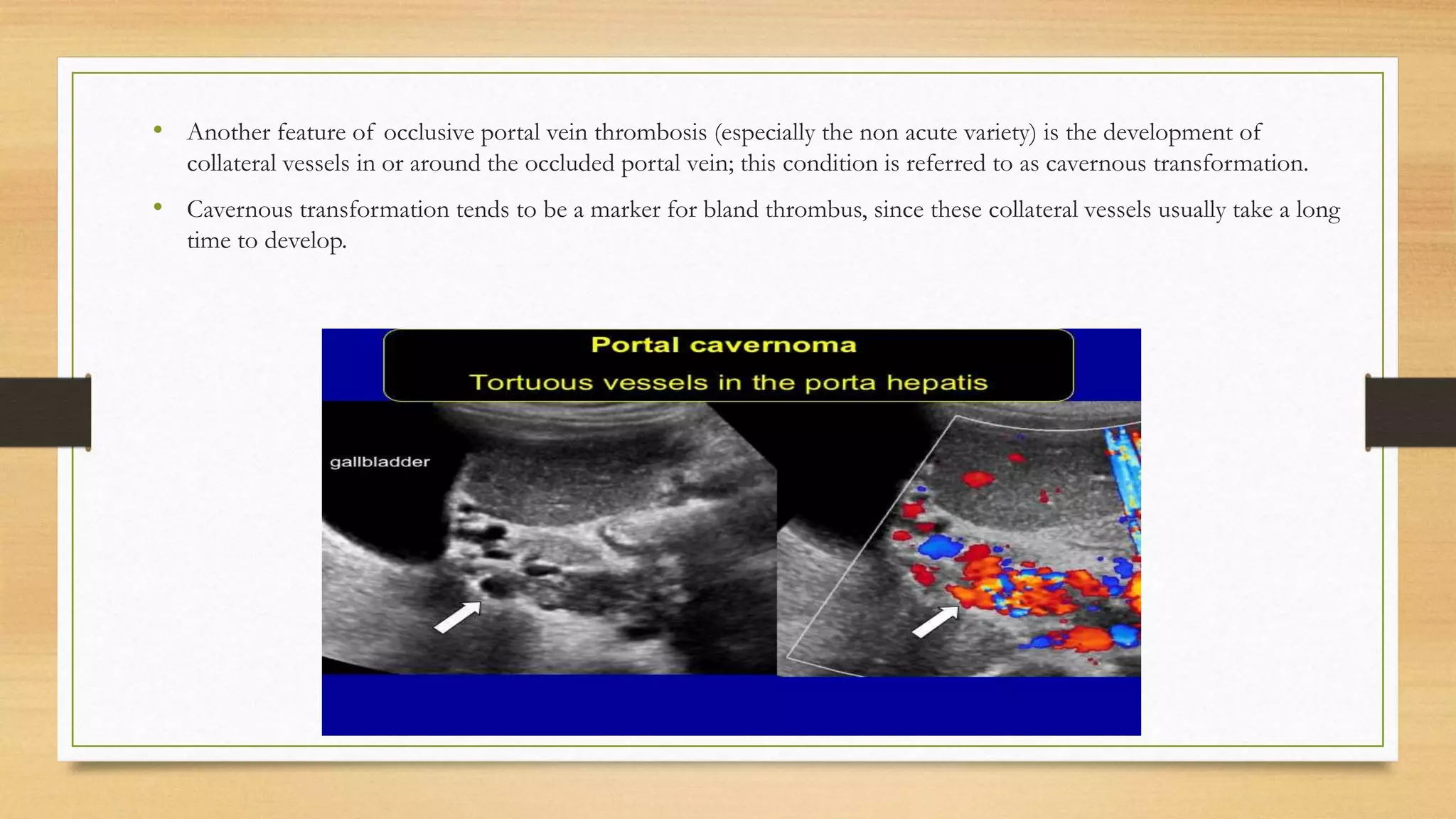 portal doppler ppt .pptx