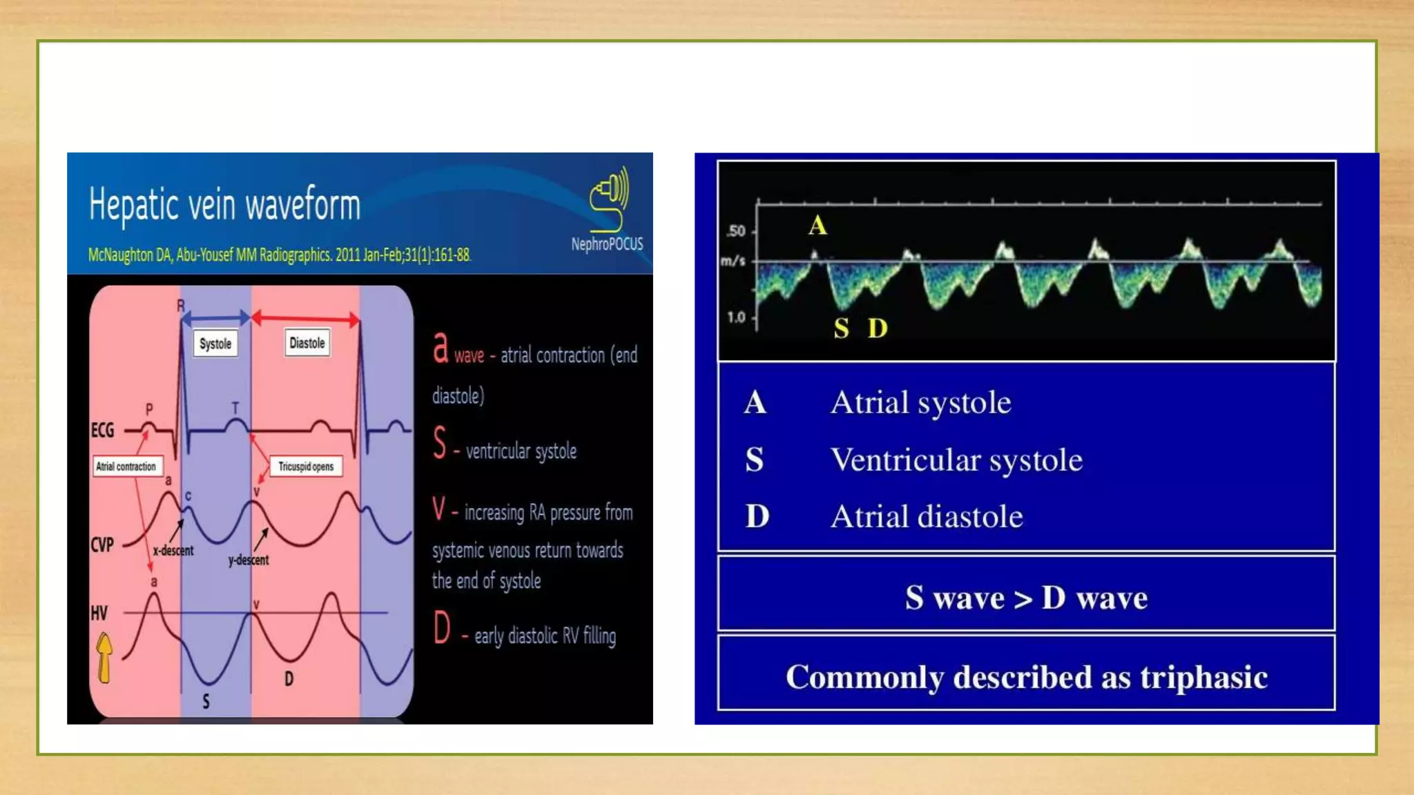 portal doppler ppt .pptx