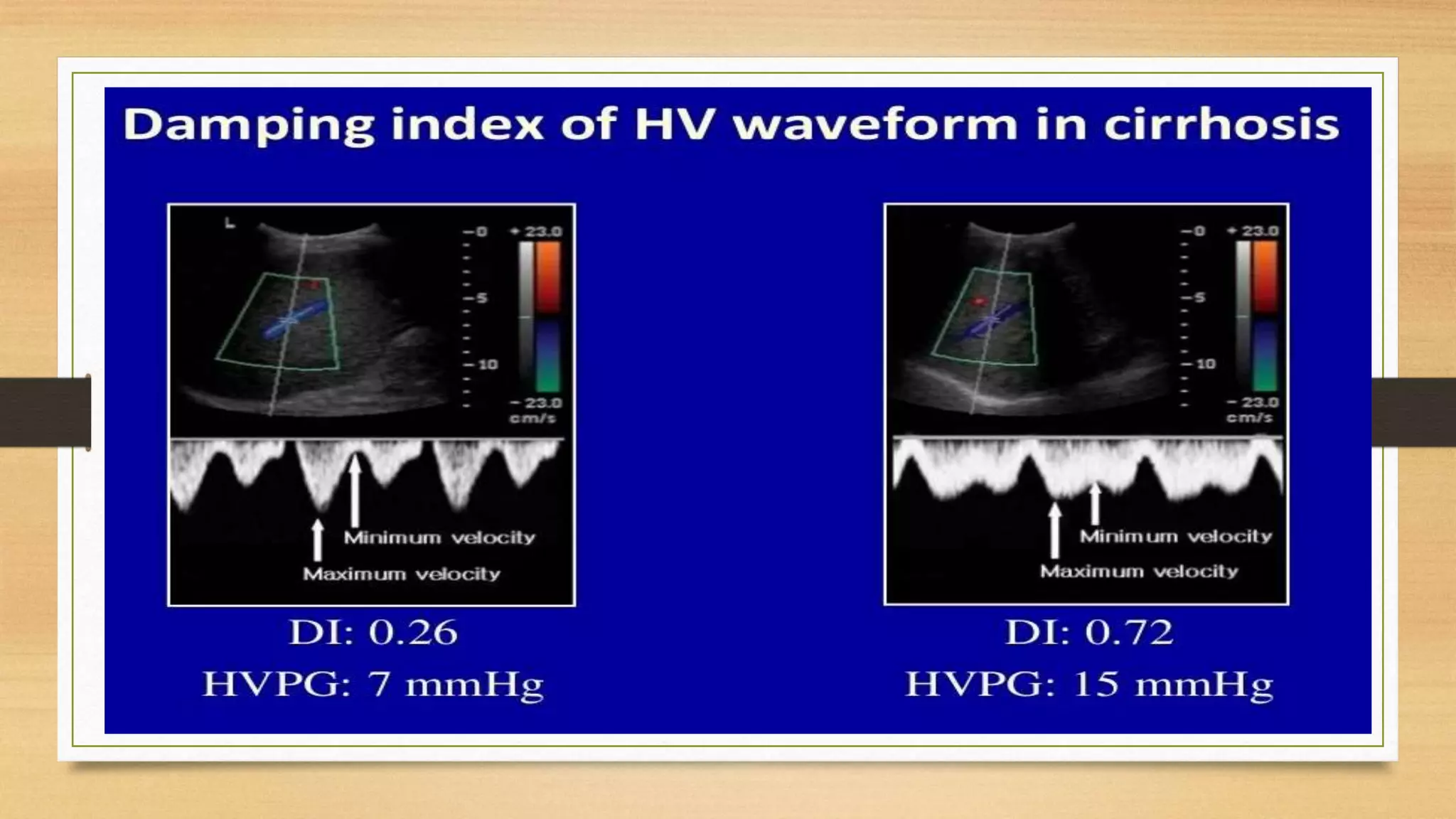 portal doppler ppt .pptx
