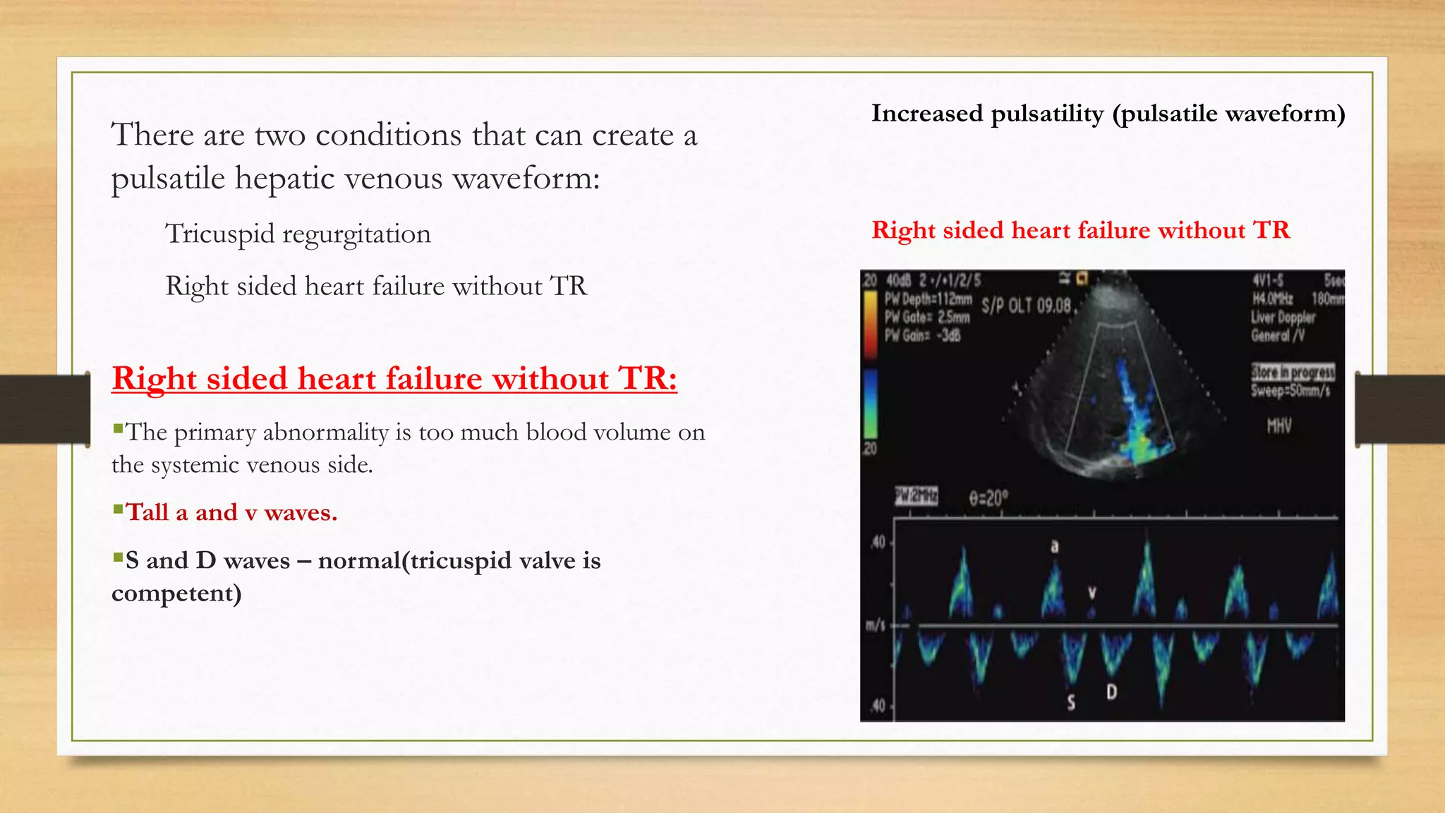 portal doppler ppt .pptx