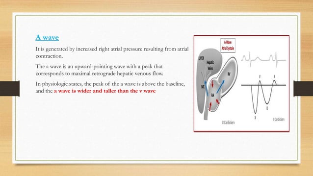 portal doppler ppt .pptx