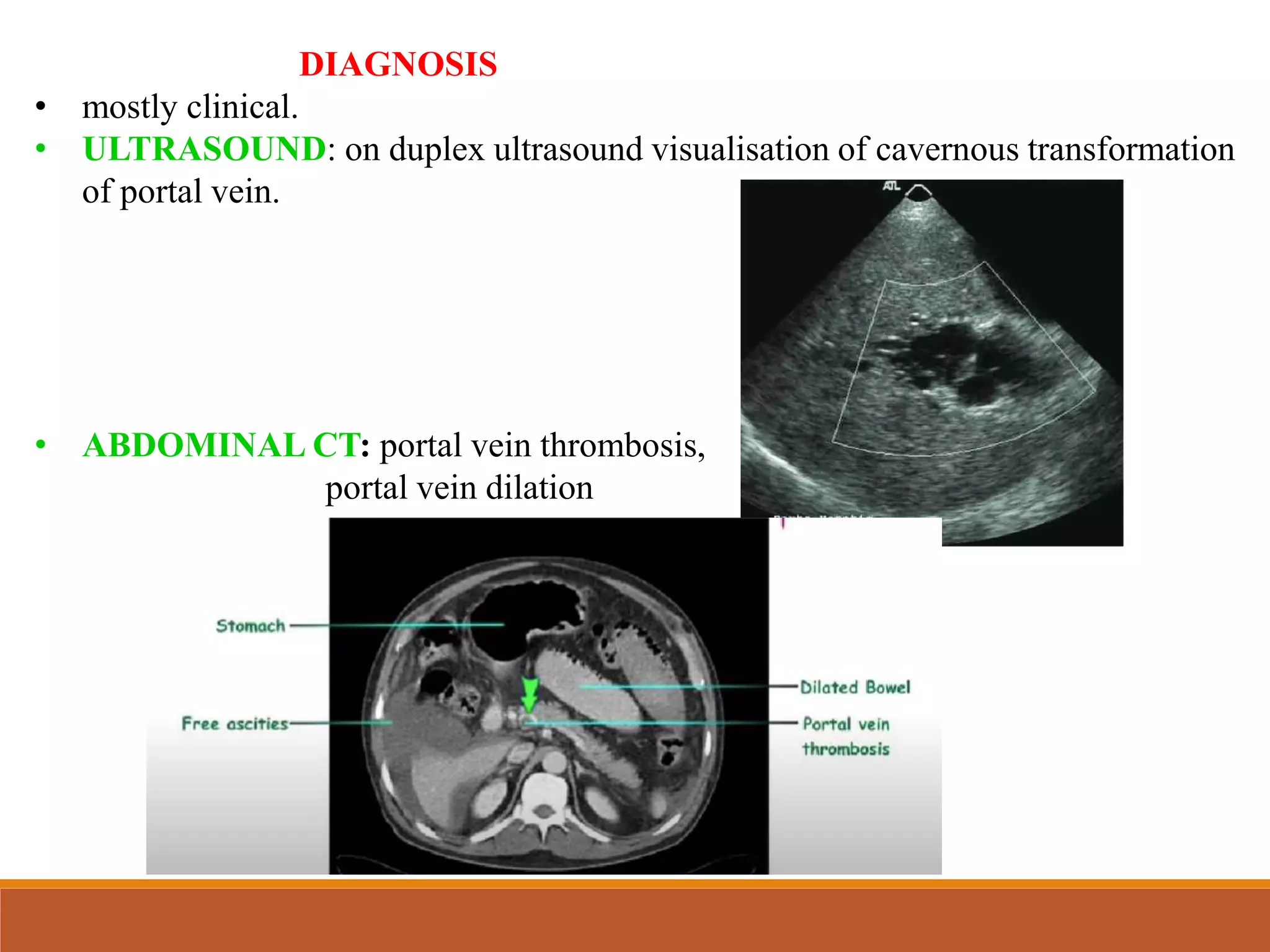 PORTAL HTN spleno renal shunt.ppt