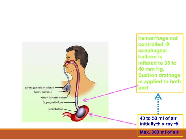 PORTAL HTN spleno renal shunt.ppt | Digestive Disorders | Diseases and ...