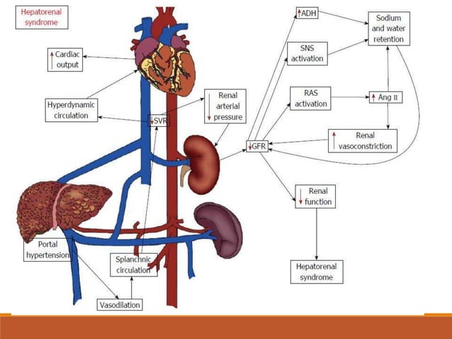 PORTAL HTN spleno renal shunt.ppt | Digestive Disorders | Diseases and ...