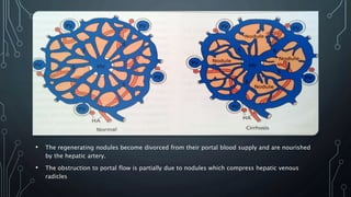Portal hypertension | PPTX