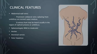 Portal hypertension | PPTX
