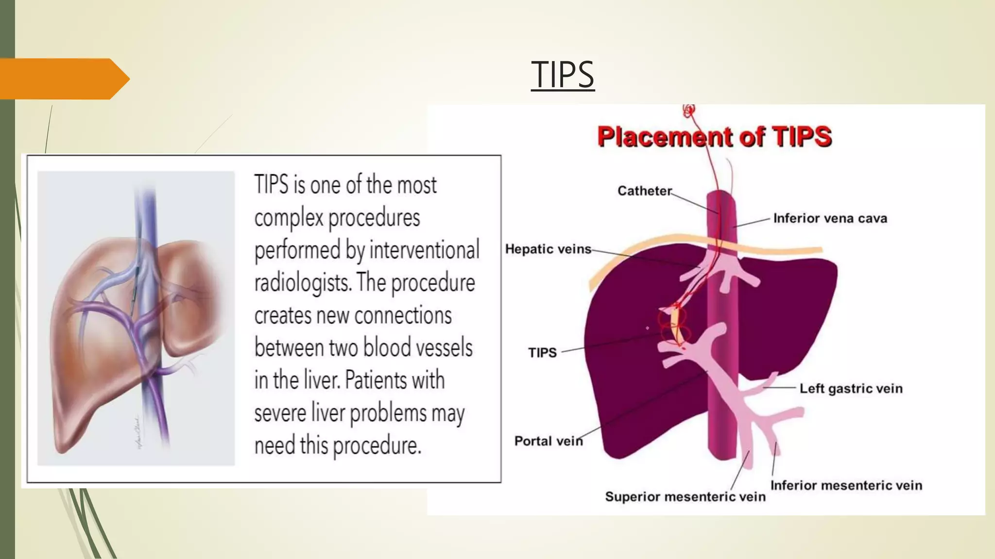 Portal Hypertension | PPTX