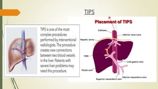 Portal Hypertension | PPTX