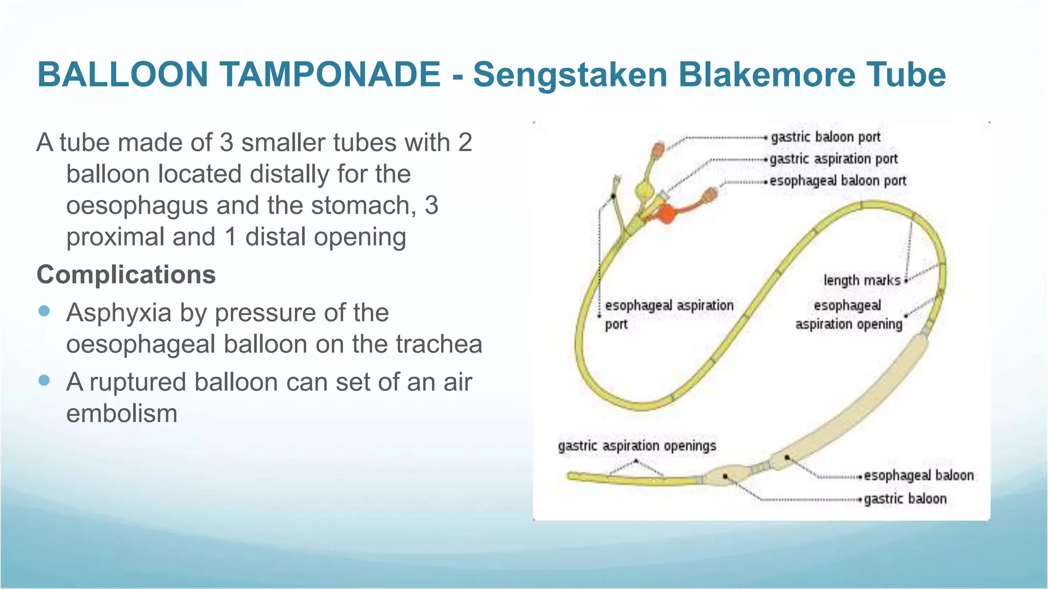 Portal Hypertension in Children | PPTX
