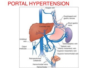 Portal hypertension | PPT