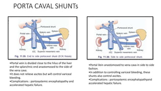 portal hypertension.pptx