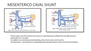 portal hypertension.pptx