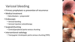 Portal Hypertension.pptx