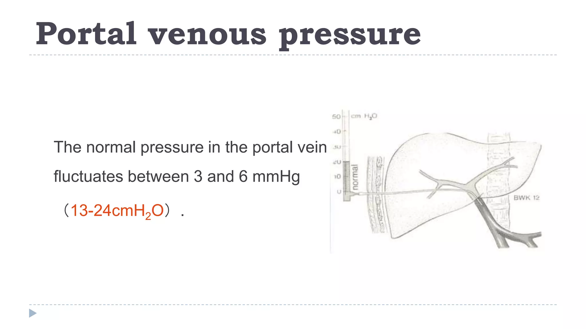 Portal Hypertension.ppt