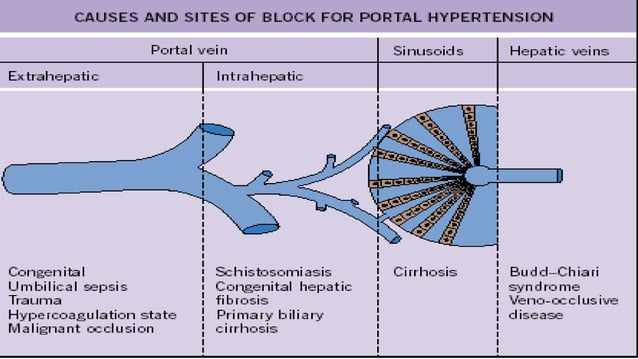 Portal Hypertension.ppt