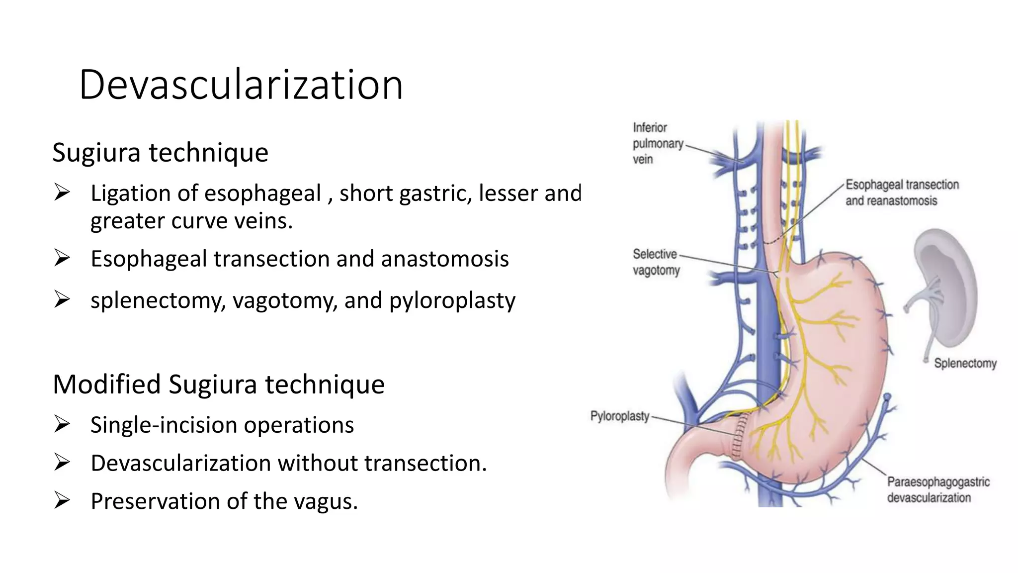 Portal hypertension | PPTX