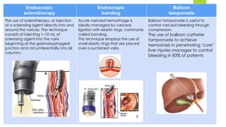 PORTAL HYPERTENSION and it's management (1).pptx