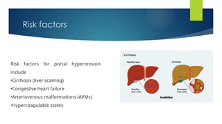 PORTAL HYPERTENSION and it's management (1).pptx