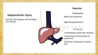 Portal Hypertension in Children | PPTX