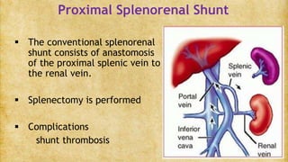 Portal Hypertension in Children | PPTX