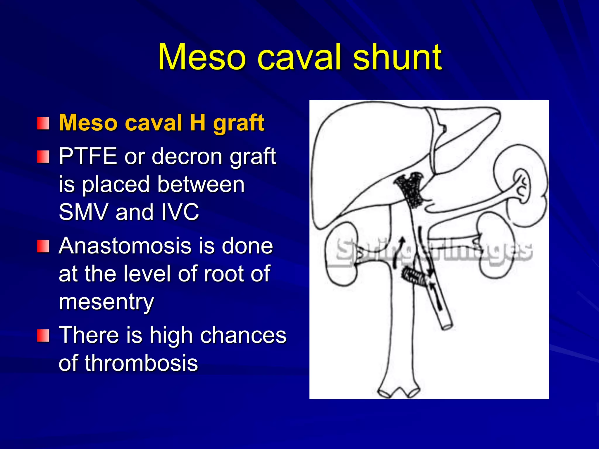 Portal Hypertension Surgical MANagement.pptx