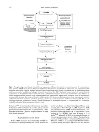 Portal Hypertension Pathophysiology Diagnosis and Treatment.pdf