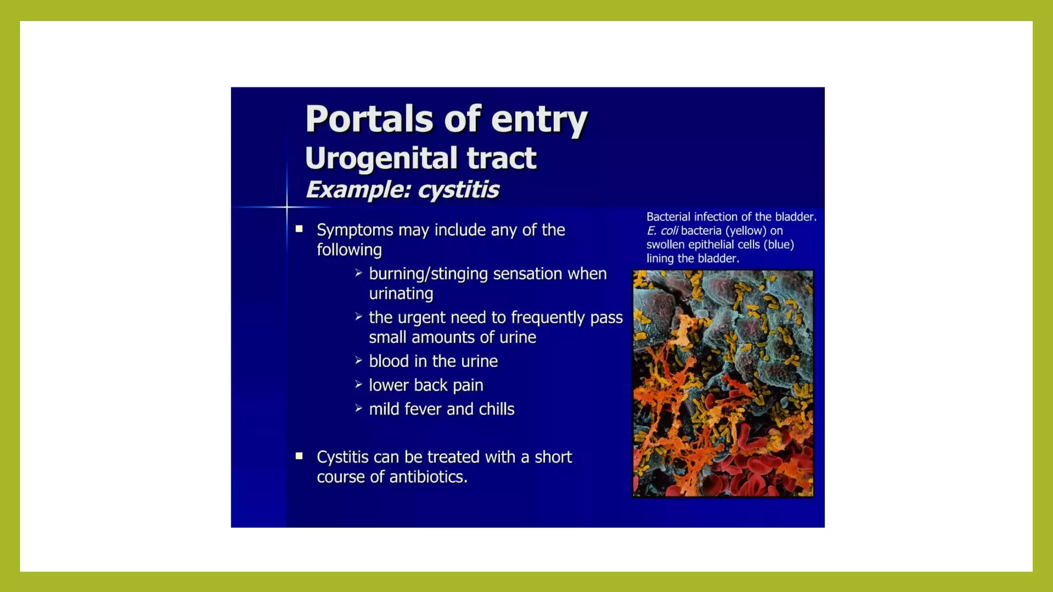 Portals of entry to human body.pptx