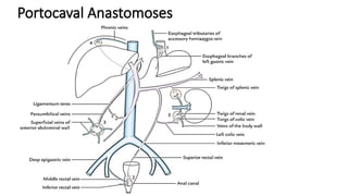 PORTAL VEIN.pptx Anatomy and Portal Hypertension | PPTX