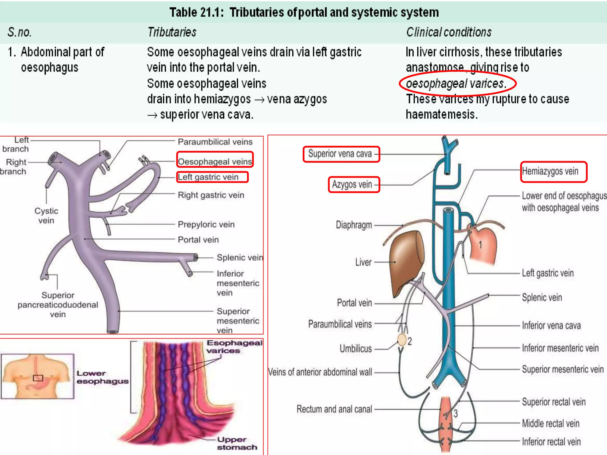 Portal vein & portocaval anastomosis | PPTX