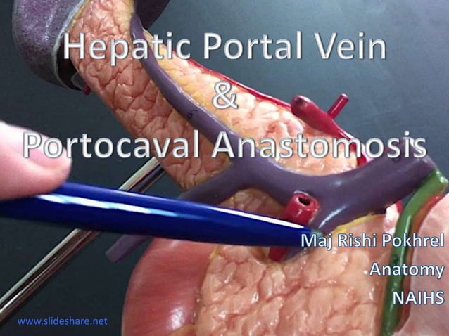 Hepatic Portal vein and portocaval anatomosis | PPTX | Digestive ...