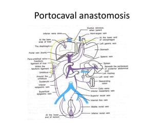 Hepatic Portal vein and portocaval anatomosis | PPTX