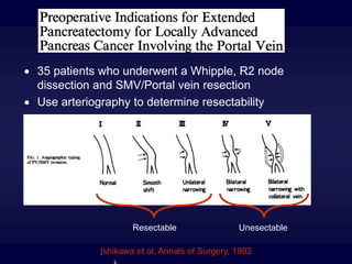 Portal vein resection | PPT