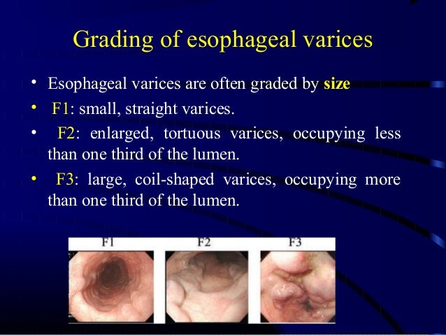 portal hypertension..classification and pathophysiology.