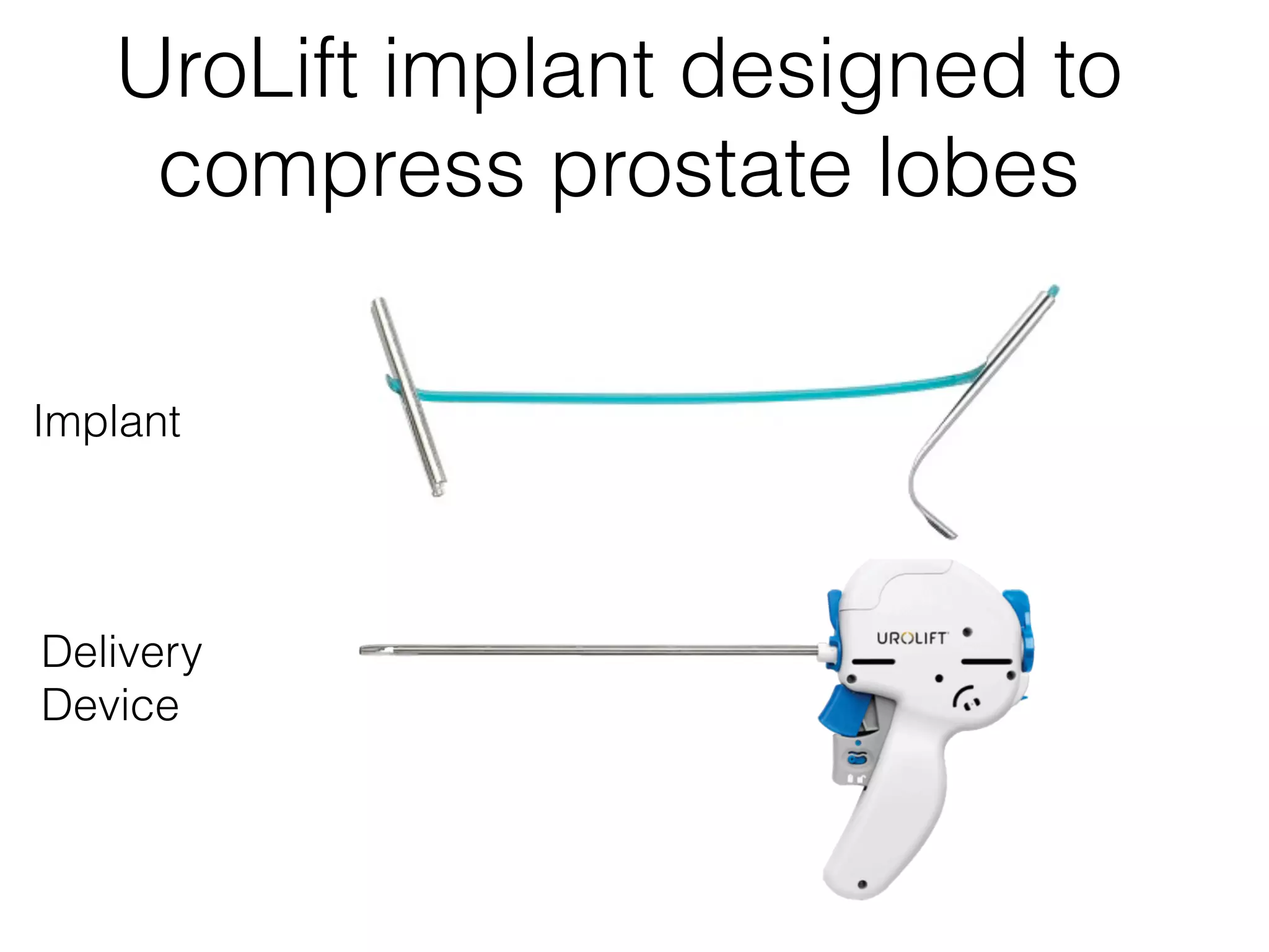 Prostate cancer detection, UroLifts, Haematuria | PDF