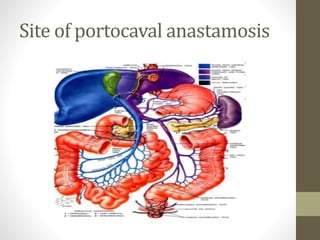 Portocaval anastamosis | PPTX