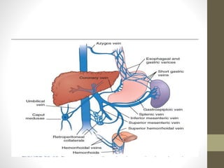 Portocaval anastamosis | PPTX