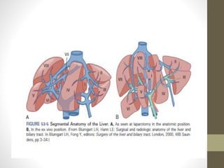 Portocaval anastamosis | PPTX