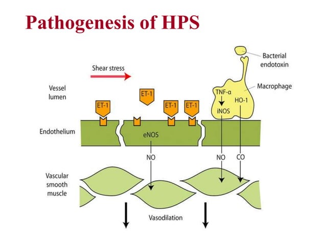 Portopulmonary hypertension and hepatopulmonary syndrome1 | PPT | Heart ...