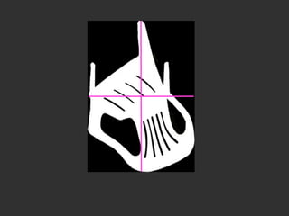 Pos and neg space | PPT