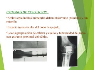 Posic.radiograf codo y_humero | PPT