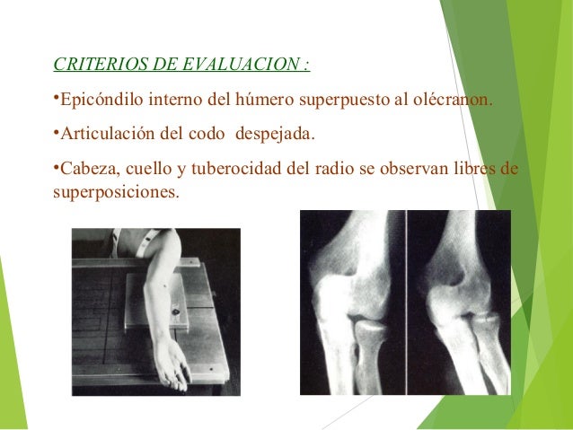 Posic.radiograf codo y_humero