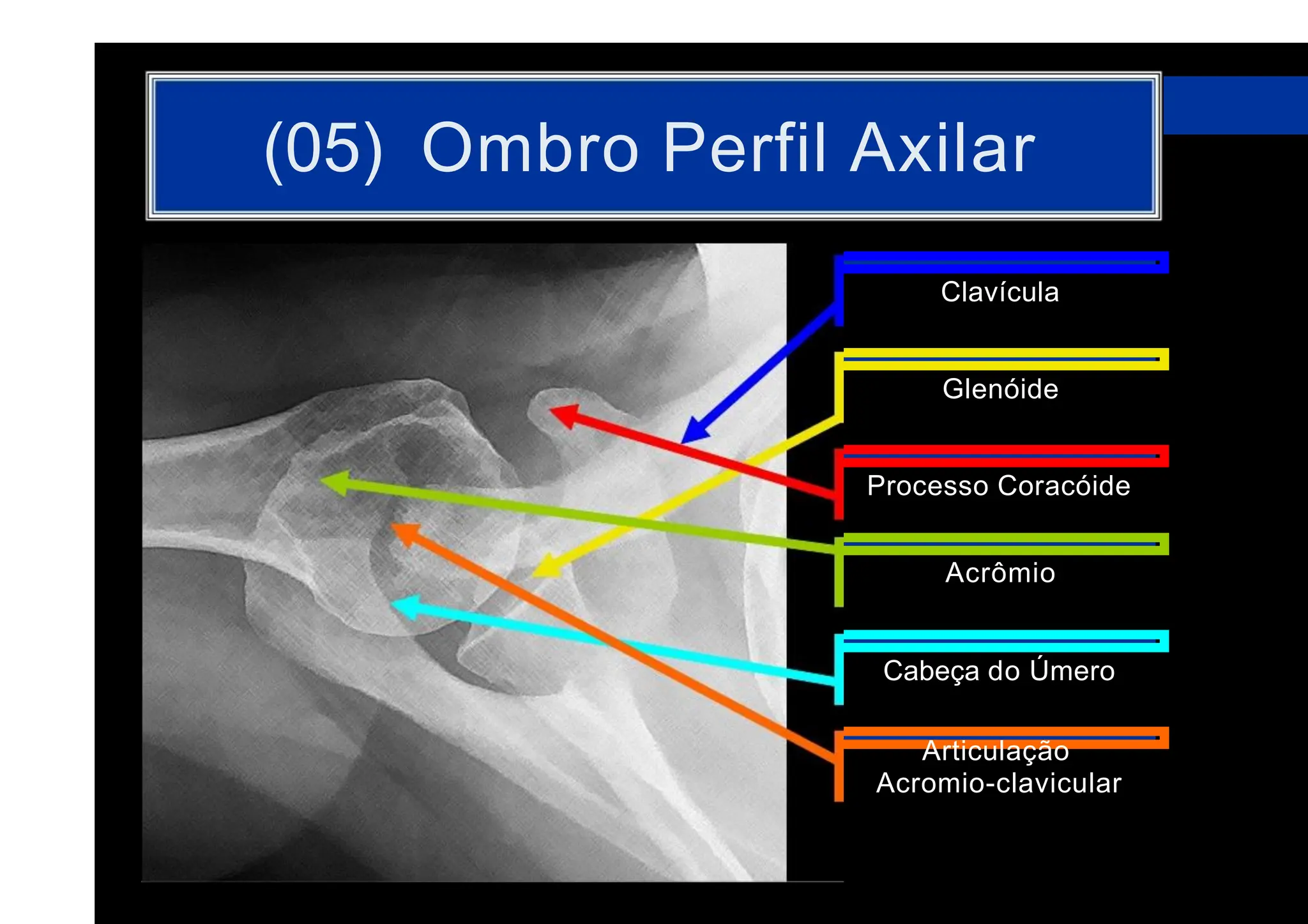 Posicionamento dos ombros para avalizaçao por RX | PDF