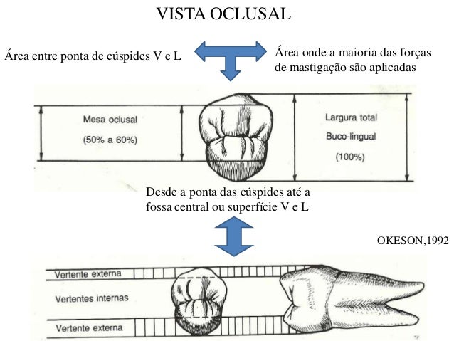 Posicionamento e oclusão dental