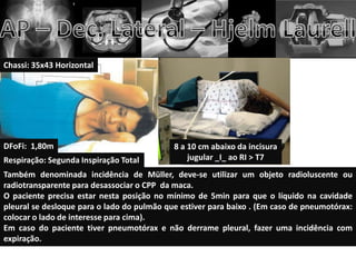 Posicionamento radiológico tórax rotina e complementares | PPTX