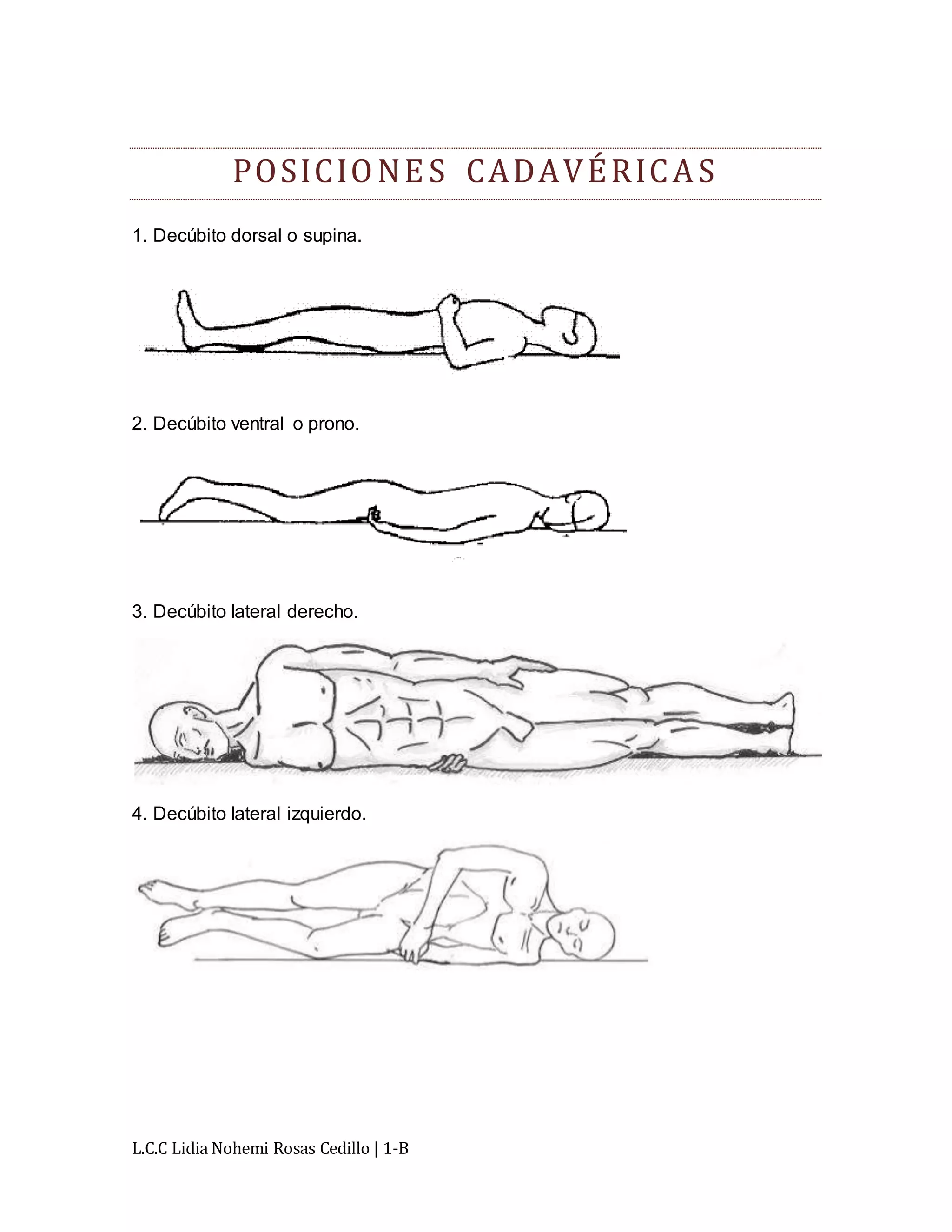 Criminalística: posiciones cadavéricas | DOCX
