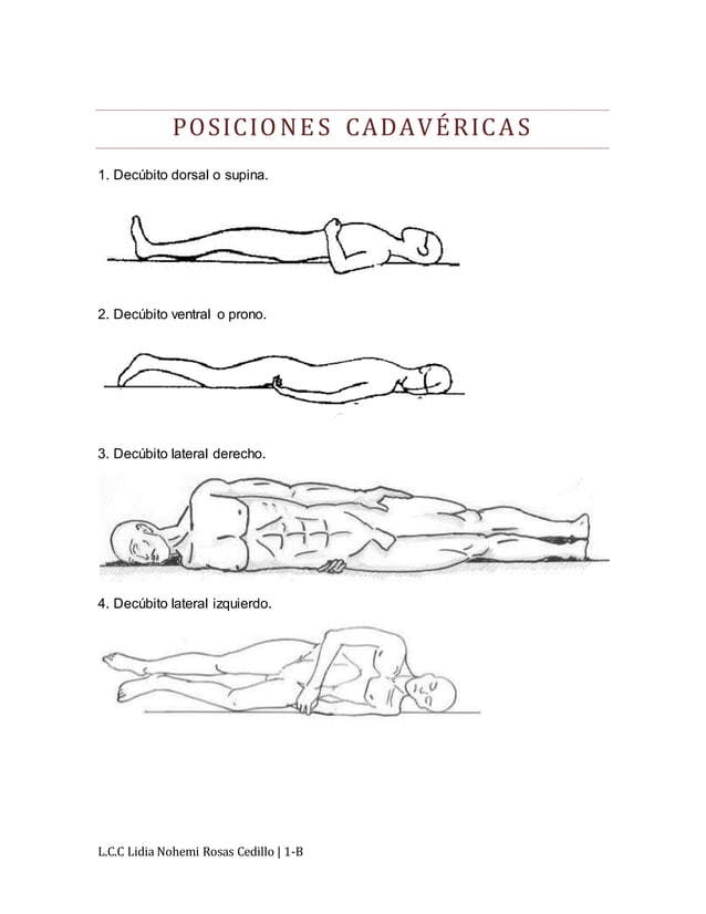 Criminalística: posiciones cadavéricas | PDF