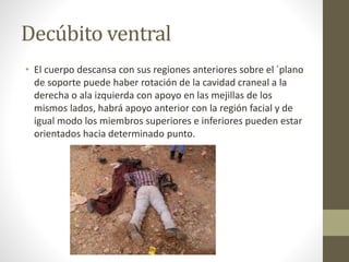 Posiciones_Cadavericas.pptx